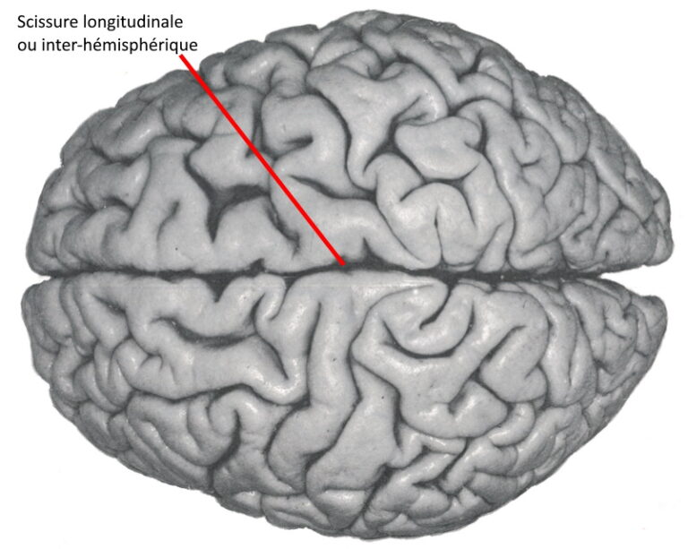 Le cortex cérébral - Neuromedia